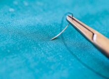 Definition of Suture and Characteristics- Universal Sutures