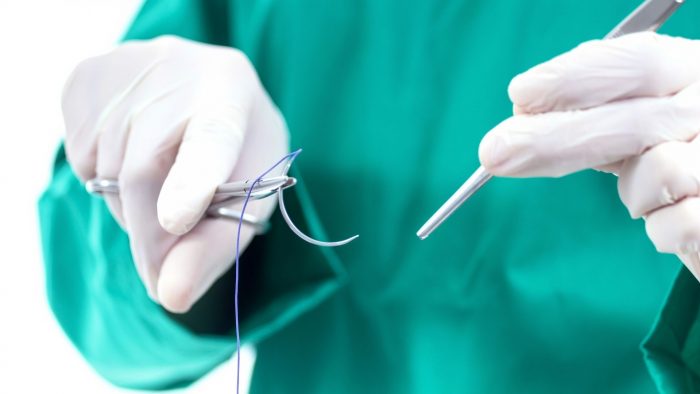 Sutures Archives - Sutures Manufacturing Company