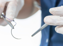 Definition of Suture - Universal Sutures