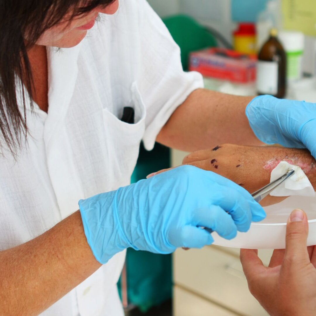 Sutures Manufacturing Company in India - Universal Sutures