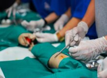 A Complete Guide on When to Remove Sutures Safely
